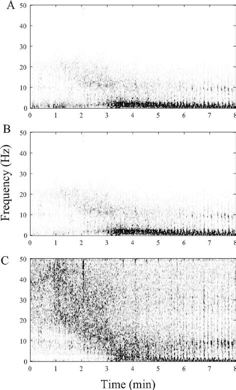 A Spectrogram Of An Electroencephalogram Recorded During Induction Download Scientific