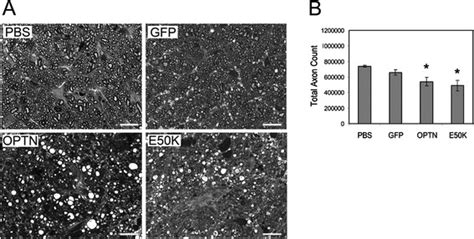 Optic Nerve Axons In Aav2 Viral Vector Injected Rat Eyes A High Power Download Scientific
