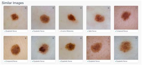 How Is Intelligent Dermatology Software Supporting Your Practice