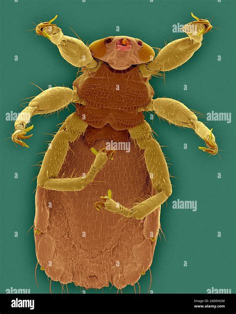 Coloured Scanning Electron Micrograph Sem Of Deer Louse Fly Adult Lipoptena Depressa The