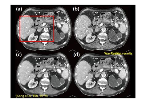 Deep Learning For Ct Reconstruction From Concept To Practices