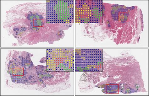 Visualization Of Highly Attentive Nodes For Rp Gcn And Tp Gcn Blue