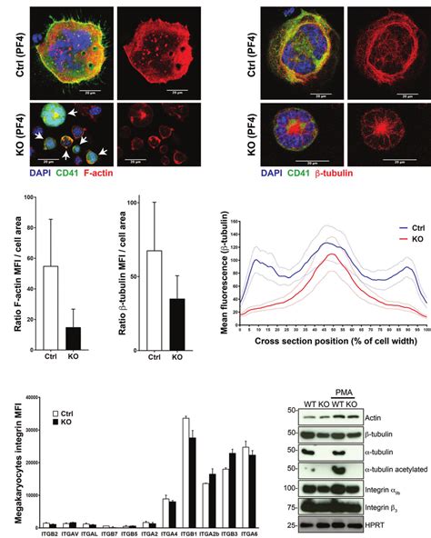 Defect In Cytoskeleton Organization In Gfi1b Null Megakaryocytes A