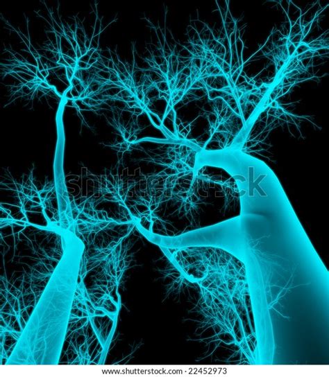 Abstract Rendering Tree Neuron Like Structure Stock Illustration 22452973 Shutterstock