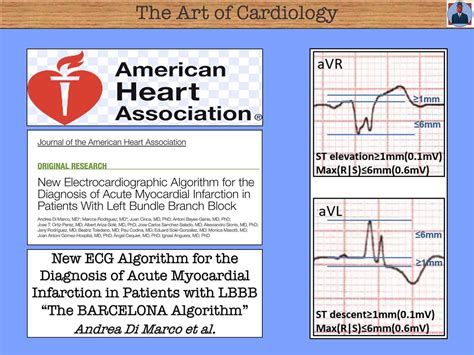 🖋new Electrocardiographic Algorithm Theartofcardiology Facebook