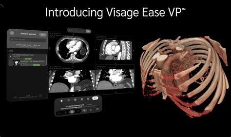 Visage Launches Visage Ease Vp™ For Apple Vision Pro Pro Medicus