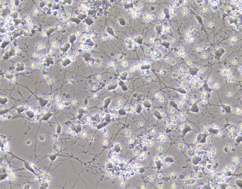 IPSC Derived Neurons Nexel Induced Pluripotent Stem Cell