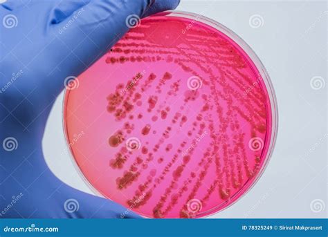 Bacterial Colonies Culture On Differential And Selective Media Stock