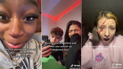 Degloved Face Know Your Meme