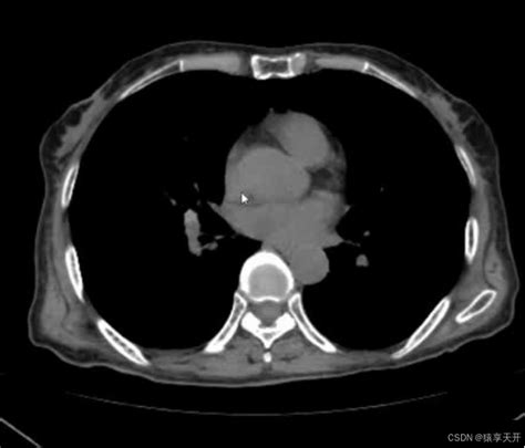 Dicom图像解析：深入解析dicom格式文件的高效读取与处理dicom文件解析 Csdn博客