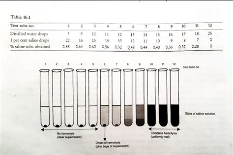 Labcorp Osmotic Fragility At Gayla Wilson Blog