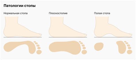 15 наболевших вопросов хирургу о кистях и стопах