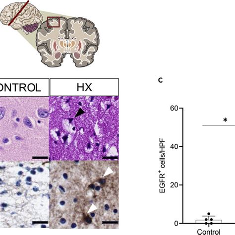 Hx Induces Egfr Activation In The Cerebral Cortex Of Human Newborns Download Scientific Diagram