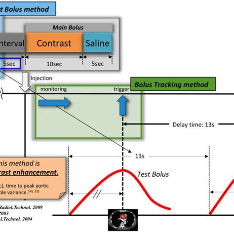 Outline Of Test Bolus Tracking Method Download Scientific Diagram
