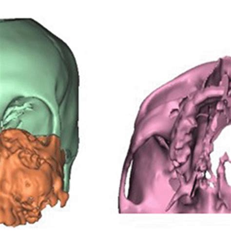 A B Showing 3d Virtual Models Of The Maxillofacial Skeleton With Download Scientific Diagram