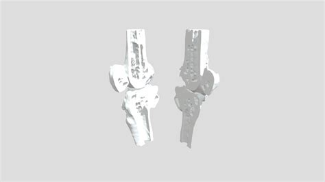 Segmentation San Rt Bone Rodsplit 3d Model By Curisdata Science