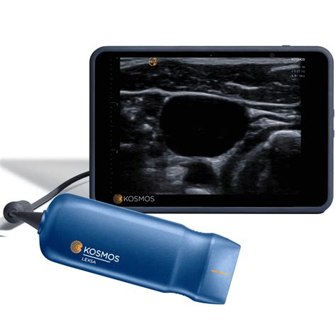 Critical Care Echonous