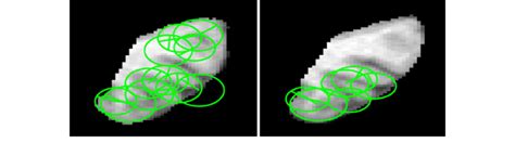 Two Succeeding Slices From The Dorsolateral Prefrontal Cortex Dlpfc