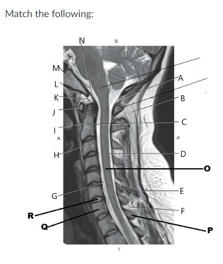 Spinal Axis Cervical Diagram Quizlet