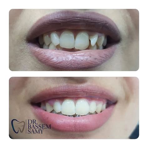 Dr Bassem Samy 💪😊 Keep A Smile On Your Face☺