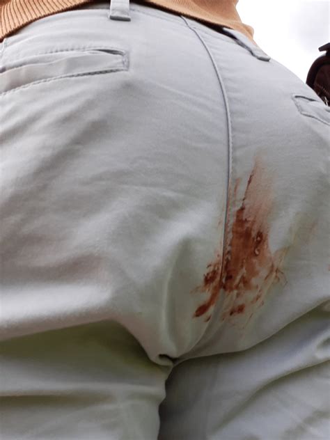 Poop Accident In Street