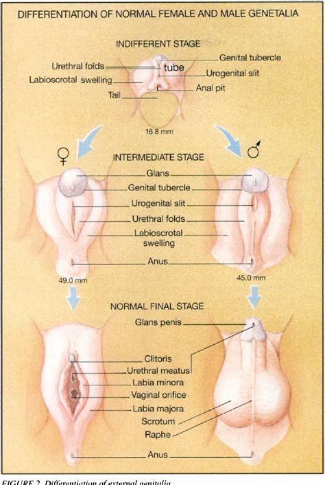 Intersex Genitalia Diagram
