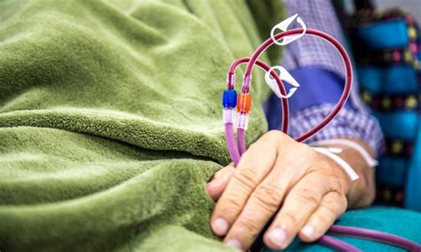 Accesos Vasculares Para Hemodiálisis Dra Maria A Díaz