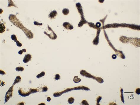Phycokey Microcystis Images