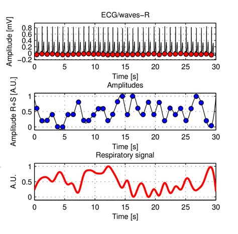 A Ecg Removal Of Baseline B Rs Amplitude C Respiratory Signal From A Download Scientific