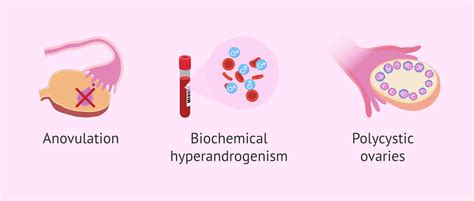 Which Methods Are Used To Diagnose Pcos
