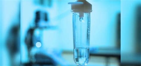 Recognizing Acute Hyponatremia