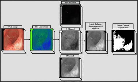 Active Contour Segmentation In Hsi Color Space Download Scientific