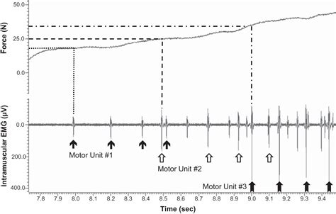 Hip Position And Sex Differences In Motor Unit Firing Patterns Of The Vastus Medialis And Vastus