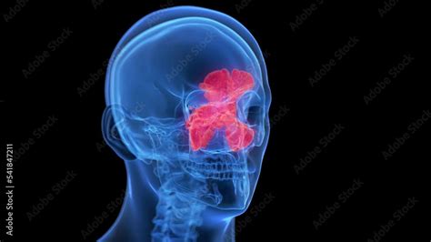 3d Rendered Medical Animation Of Inflamed Sinuses Stock Video Adobe Stock