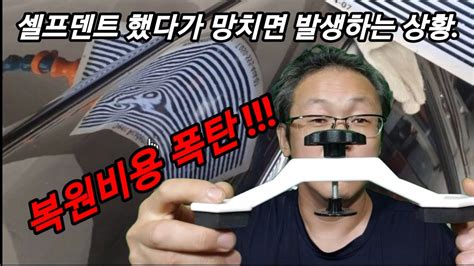 셀프덴트 했다가 망치면 발생하는 상황 복원비용 폭탄 맞습니다 Youtube