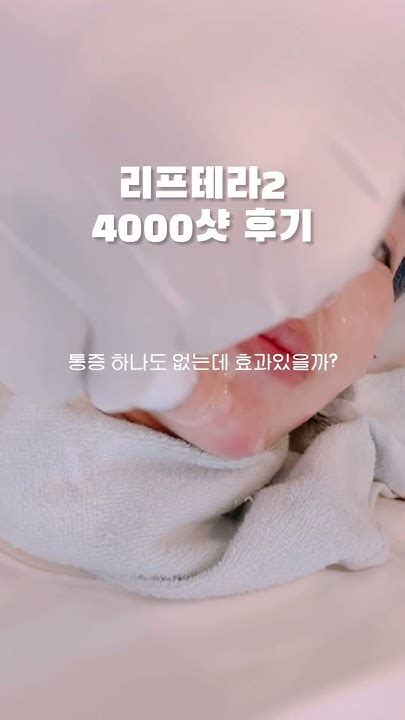 리프테라2 팔자주름 후기초음파레이저리프팅레이저 Youtube