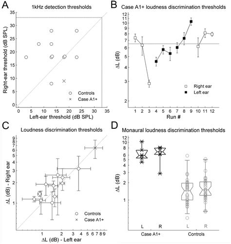 Figure 3 From Mit Open Access Articles Dissociation Of Detection And