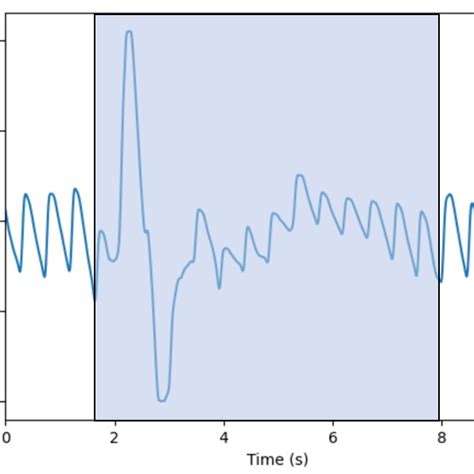 Example Of A 10s Segment Of A 30s Raw Ppg Signal In The Top Image