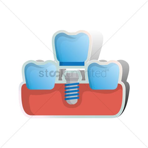 Denture Vector At Collection Of Denture Vector Free