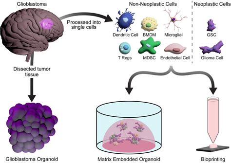Modeling Glioblastoma Complexity With Organoids For Personalized
