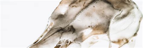 Scalp Anatomy Layers Of The Scalp