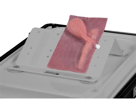 Gall Bladder With Wide Common Bile Duct And Stones For Exploration