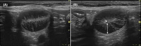 What Is A Normal Minimum Usg For A Dog