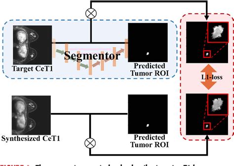 Figure 1 From Tumor Attentive Segmentation Guided Gan For Synthesizing