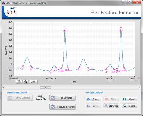 How To Use The New ECG Feature Extractor Ver NI Community
