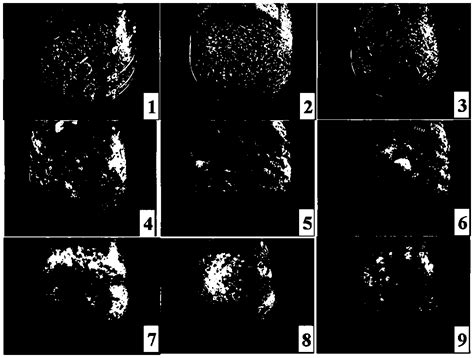 Fermentation Medium Suitable For Sporulation Of Metarhizium Anisopliae