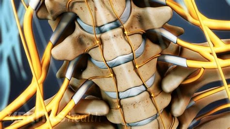 Cervical Degenerative Disc Disease Treatment Options Spine Health
