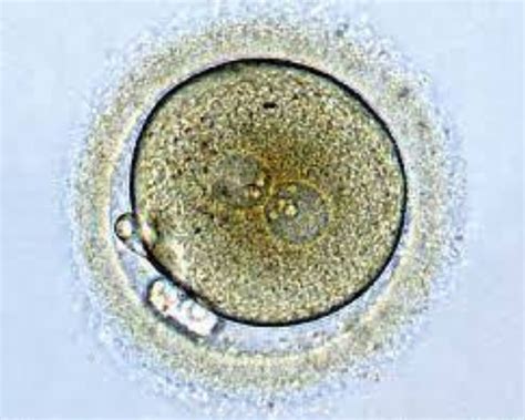 Zygote Notes From The Trail