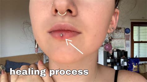 Lip Piercing Healing Stages Timeline Explained Stages 0 3