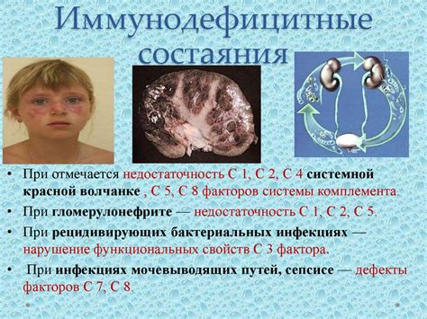 Иммунодефицитные состояния - презентация онлайн